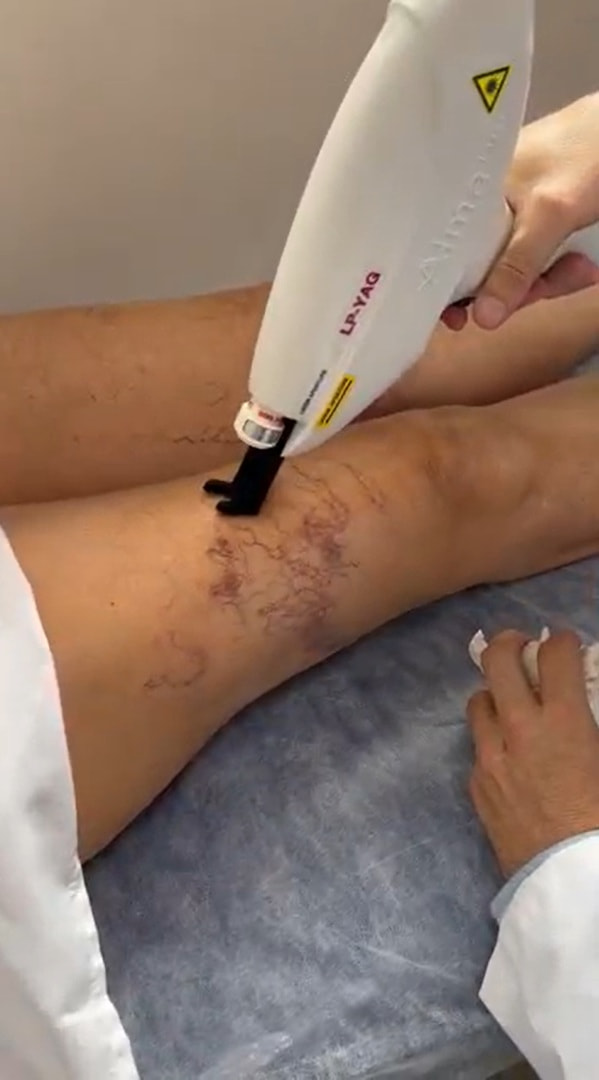 Centro de Flebología en Córdoba | Dr. Jose Allende