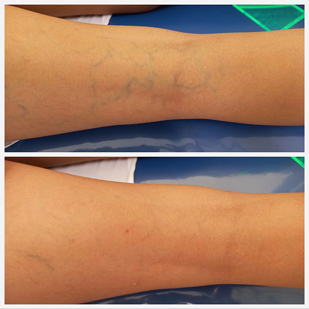 Centro de Flebología en Córdoba | Dr. Jose Allende