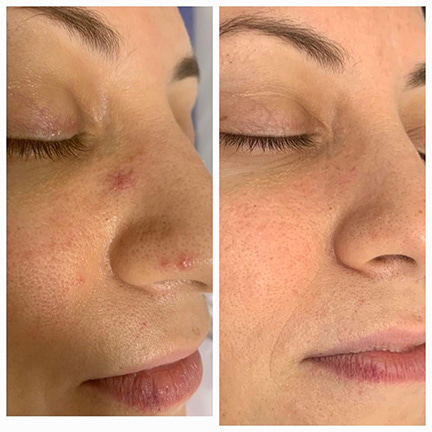 Centro de Flebología en Córdoba | Dr. Jose Allende