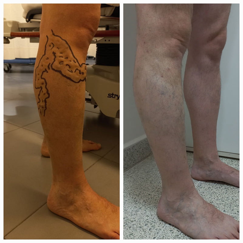 Centro de Flebología en Córdoba | Dr. Jose Allende