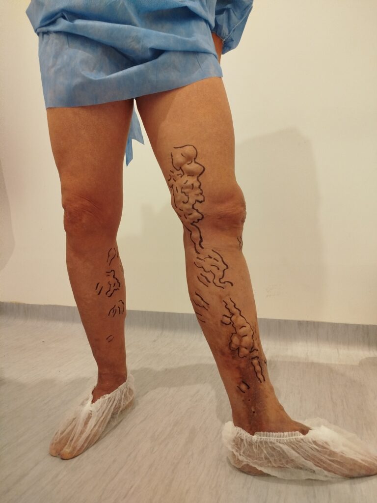 Centro de Flebología en Córdoba | Dr. Jose Allende